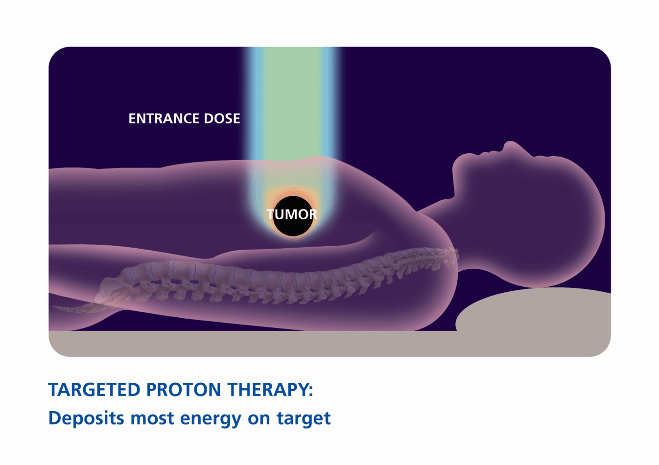 Proton Therapy FAQ | The University Of Kansas Cancer Center