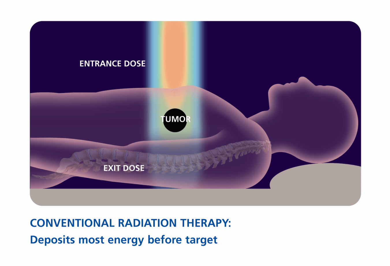 Proton Therapy FAQ | The University Of Kansas Cancer Center